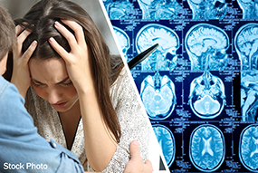 CranialScan.com - The AngioFoundation